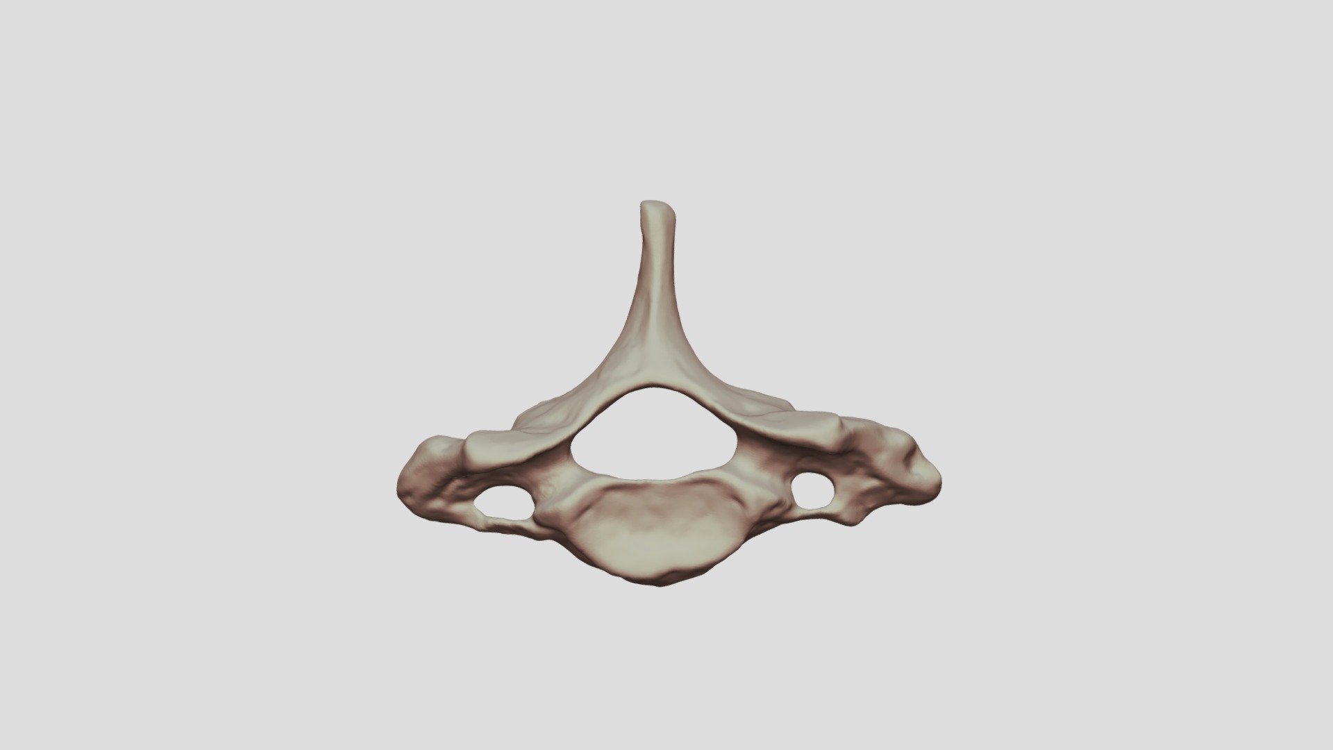 Human C7 Vertebra (Vertebra Prominens) - 3D model by LivingLab (@living ...