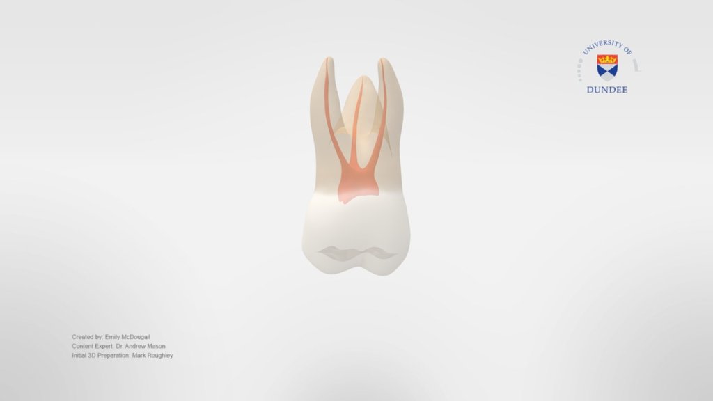 Maxillary First Molar with Two Root Canals - Download Free 3D model by ...