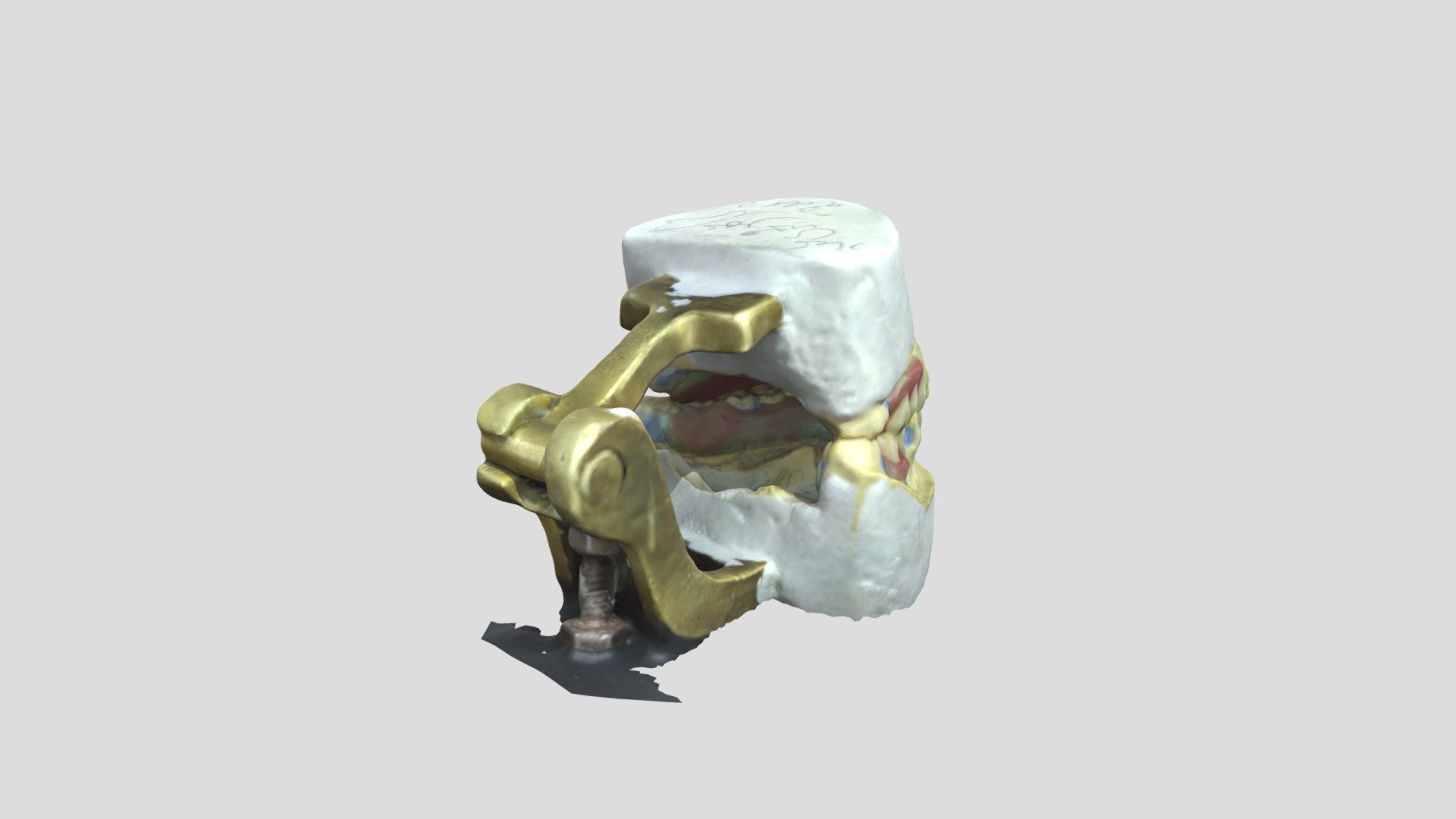 Partial Denture Try-In Stage For Partial Denture - Download Free 3D ...