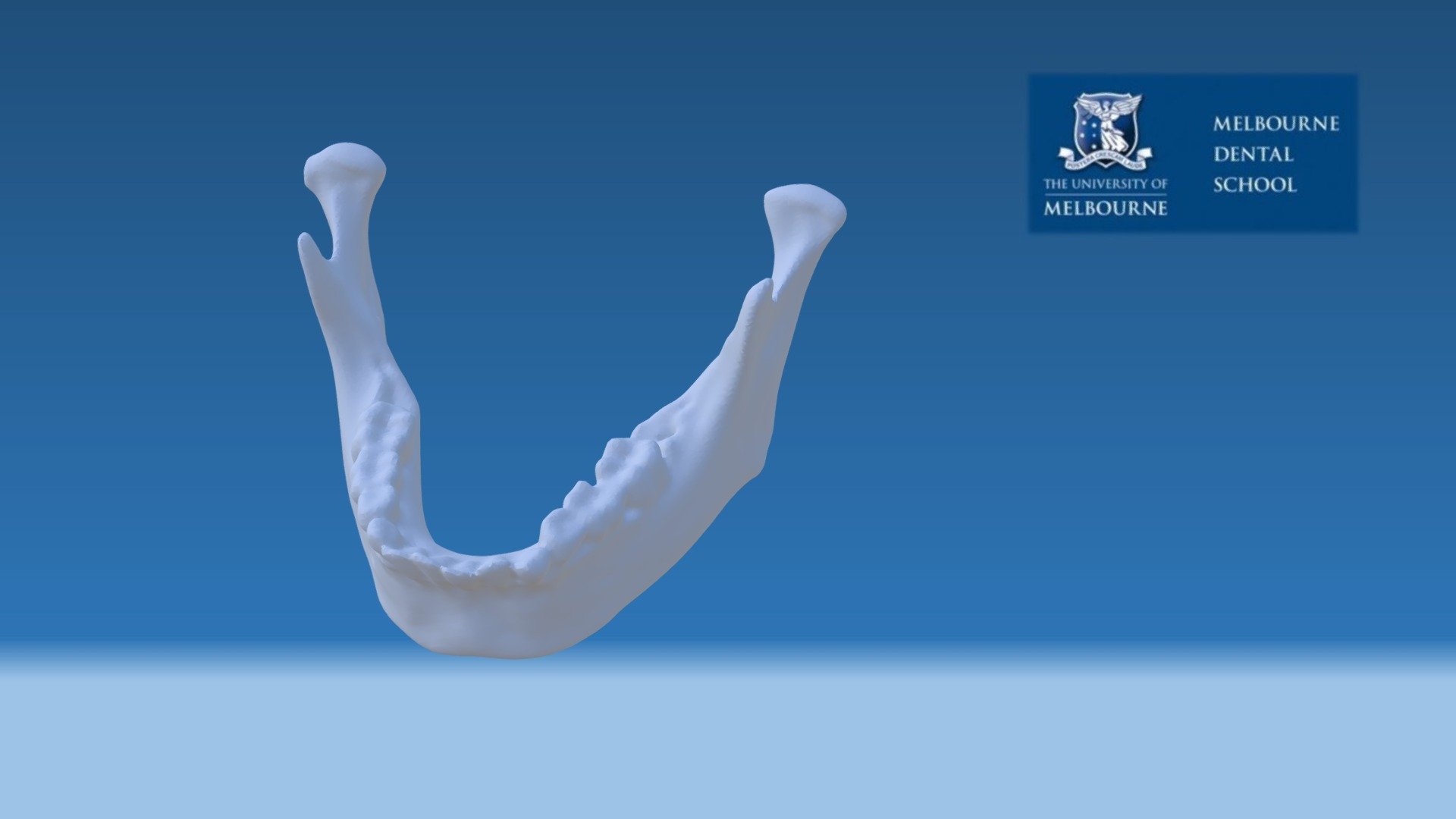Mandible 9 Complete - 3D model by Melbourne Dental School ...