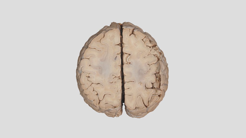 Neuroanatomy - A 3D model collection by dr_rampf - Sketchfab
