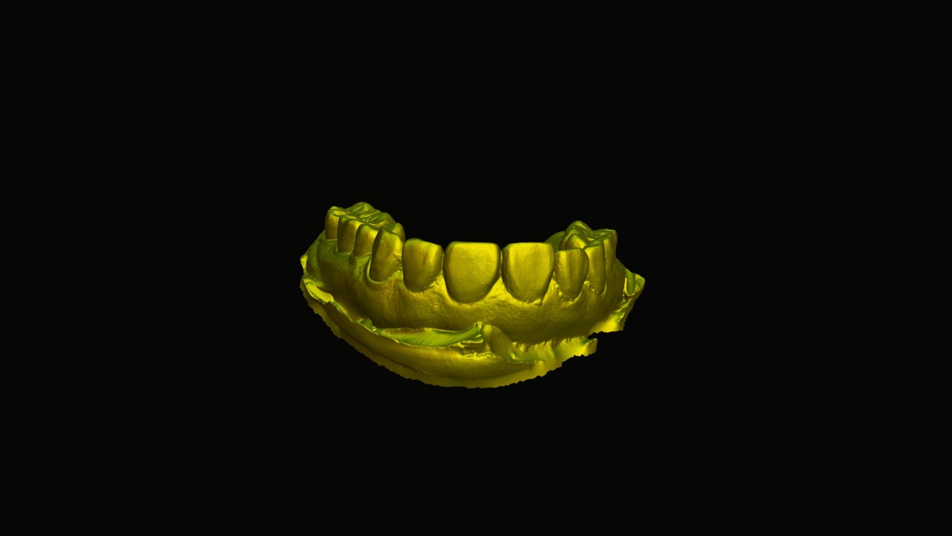 Upper Arch - Download Free 3D model by Nancy/Lanzi Luo (@Thunk3D-Nancy ...