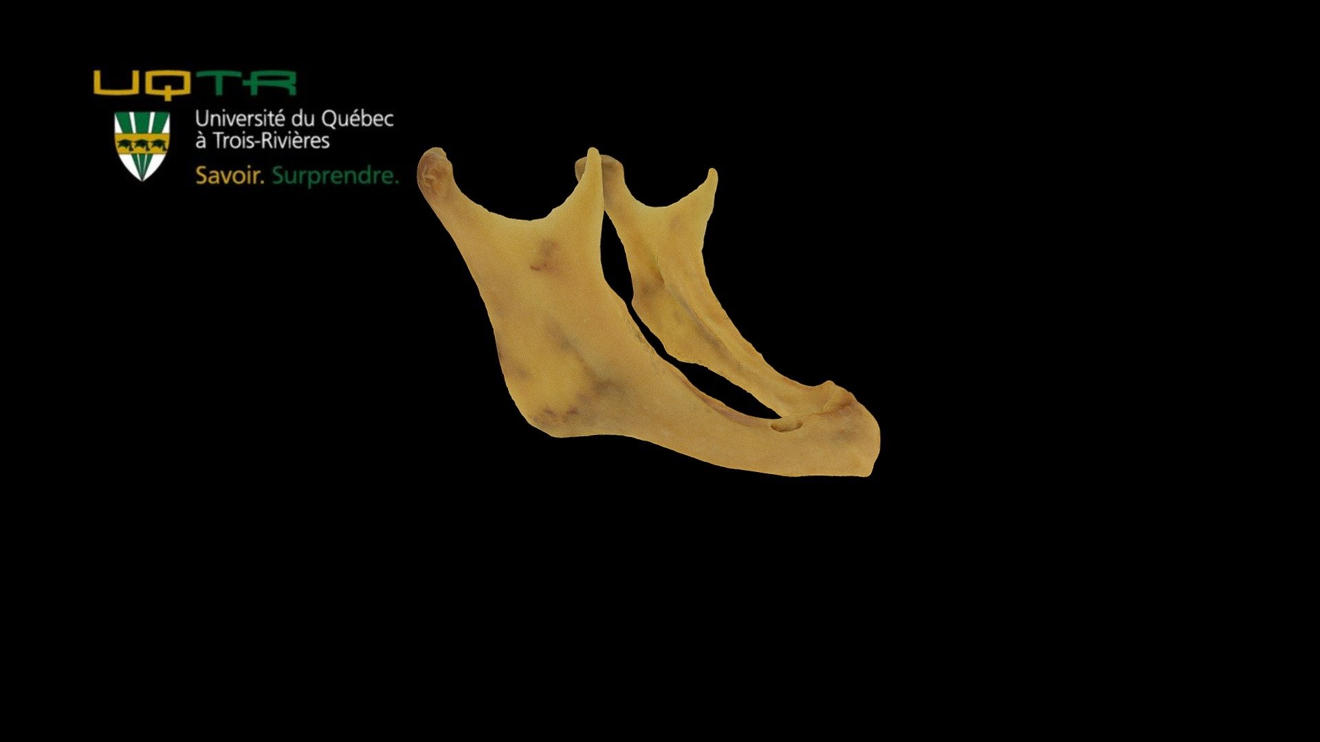 Mandibule édentée / Toothless mandible - 3D model by Anatomie UQTR ...