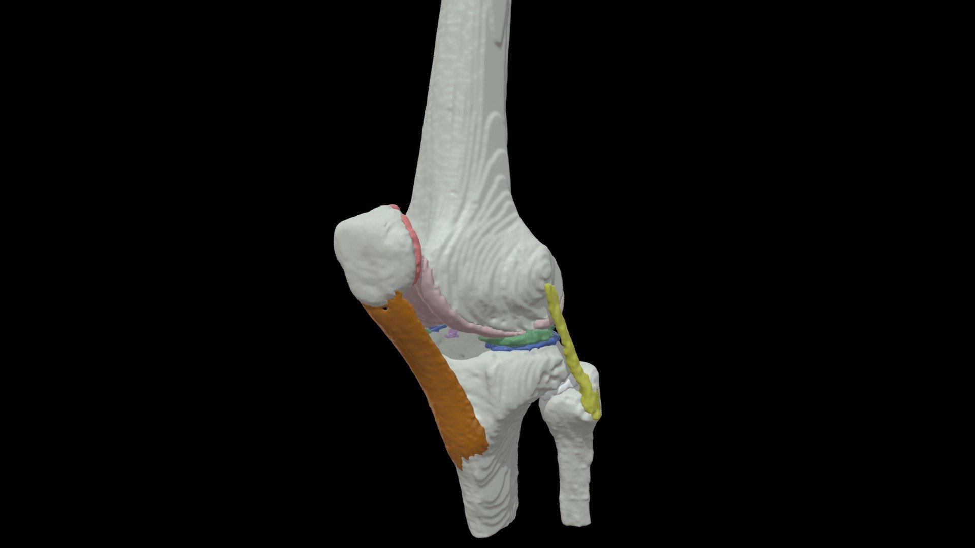 MRI Knee - 3D model by sarahiannucci [96f4e5f] - Sketchfab