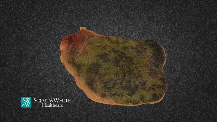 Gallbladder 3D models - Sketchfab