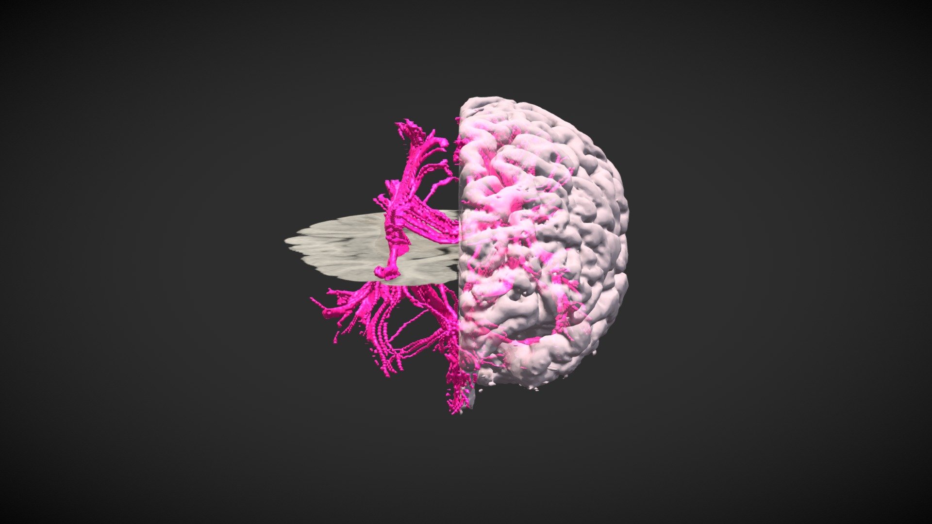 DTI Test - 3D model by Lincoln Wong (@lincolnwong) [986369f] - Sketchfab