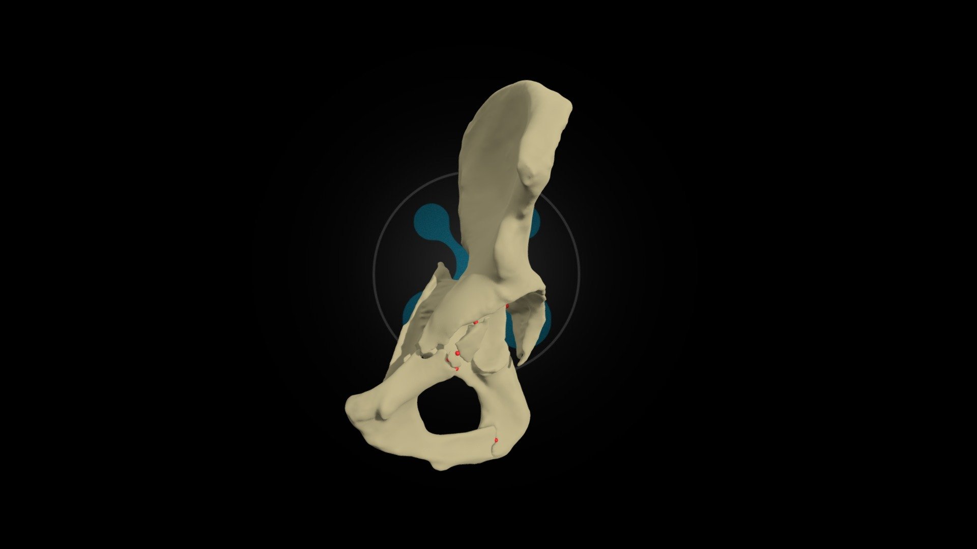 HumanX Acetabulum Fracture left #001 - 3D model by HumanX Medical ...