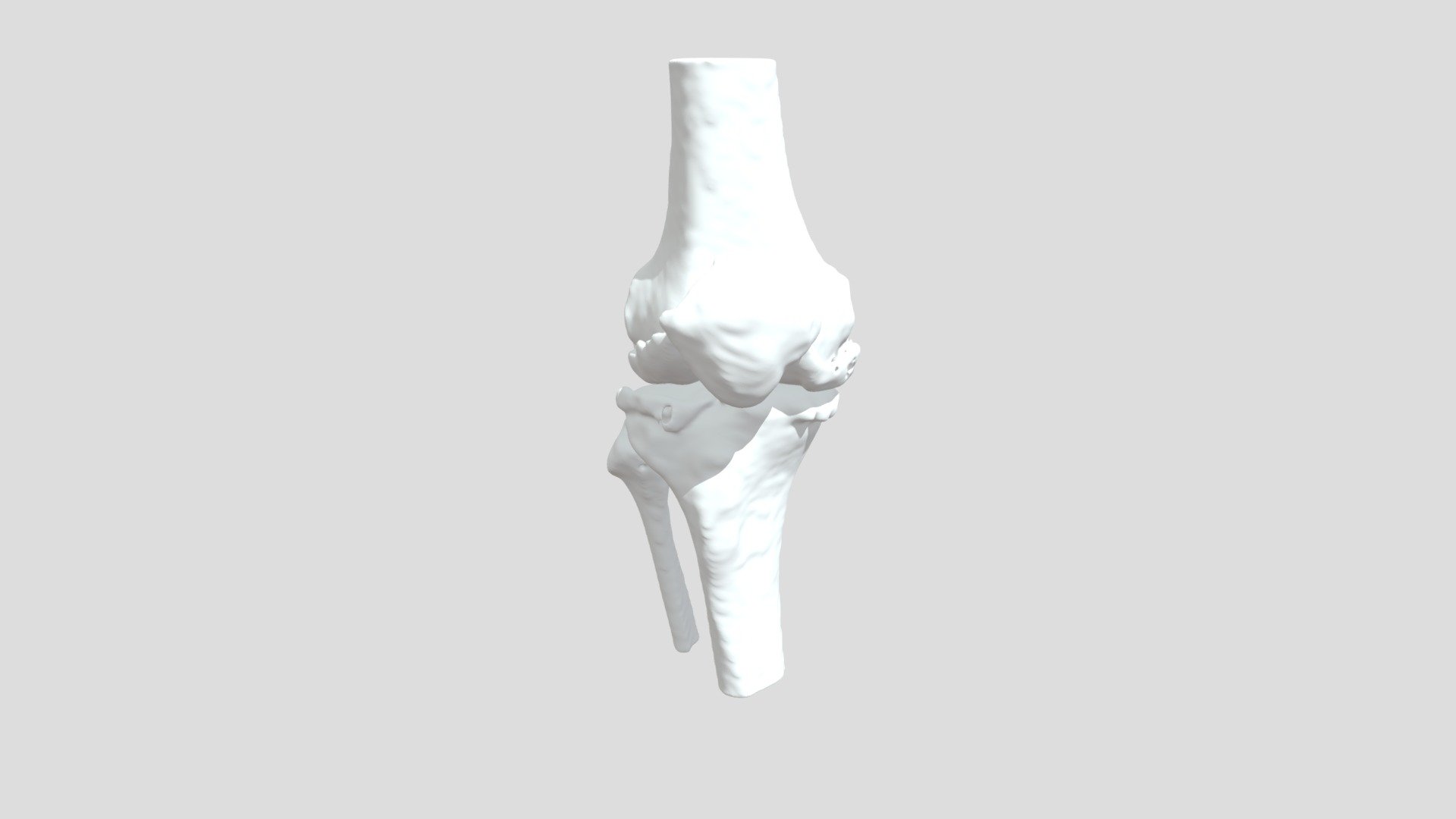 Segmentation So S Pat Rt Bone - 3D model by curisdata.science [9876ad5 ...