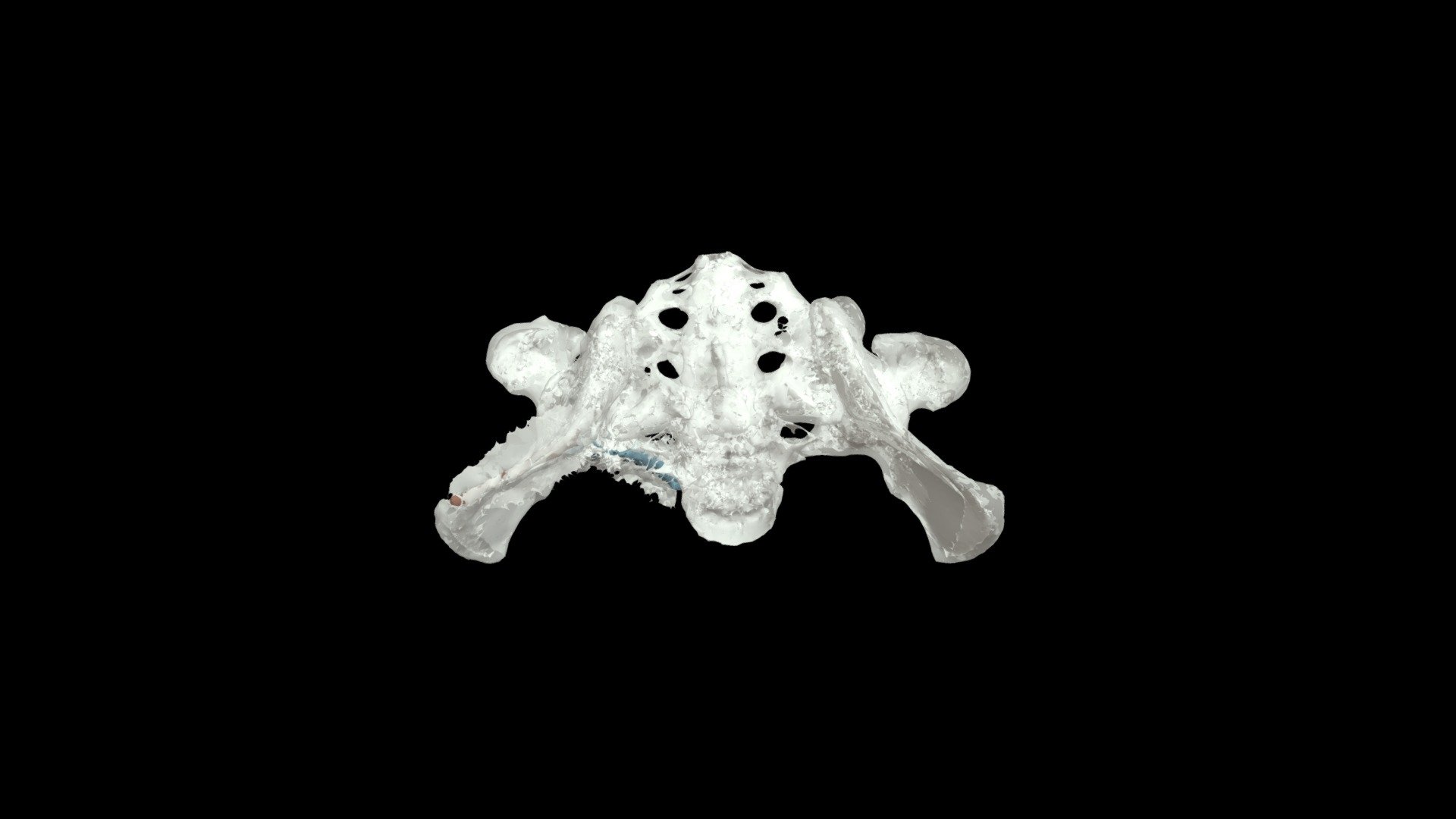 Pelvic Segmentation 3d Model By Dominic3737 [987a700] Sketchfab