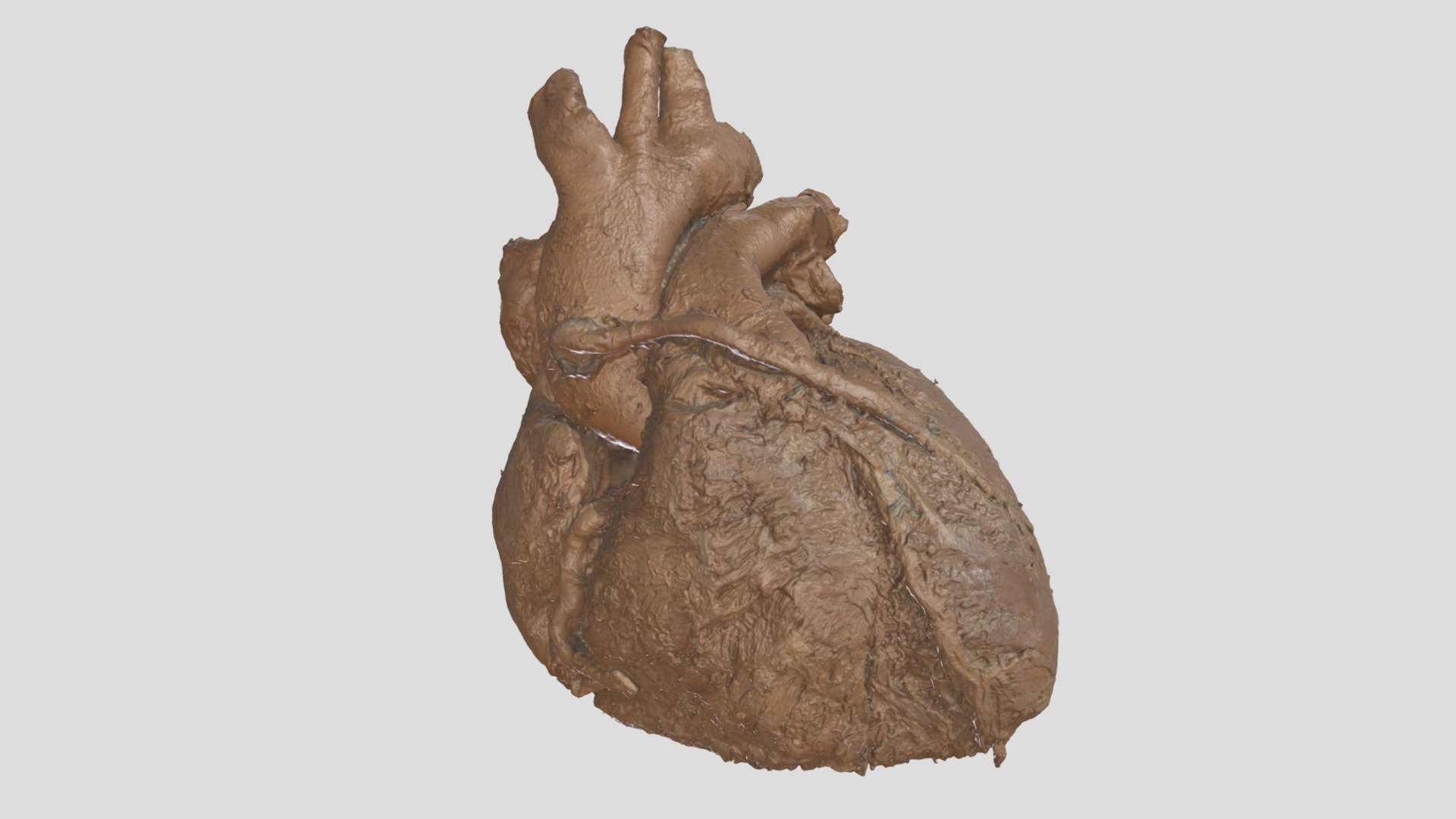 Human Heart Cardiac Bypass - Download Free 3D model by CU Modern Human ...