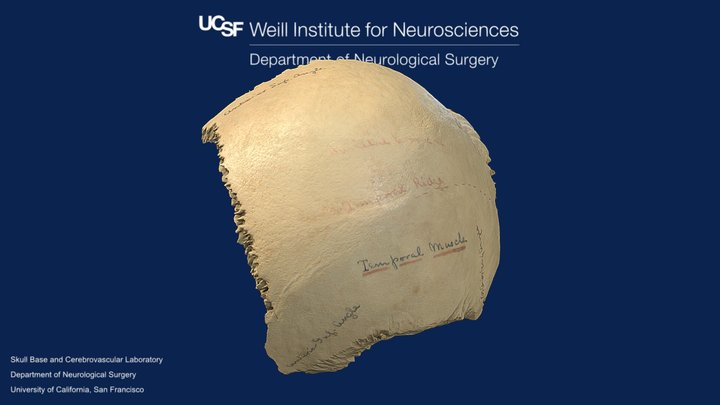 Parietal 3D models - Sketchfab