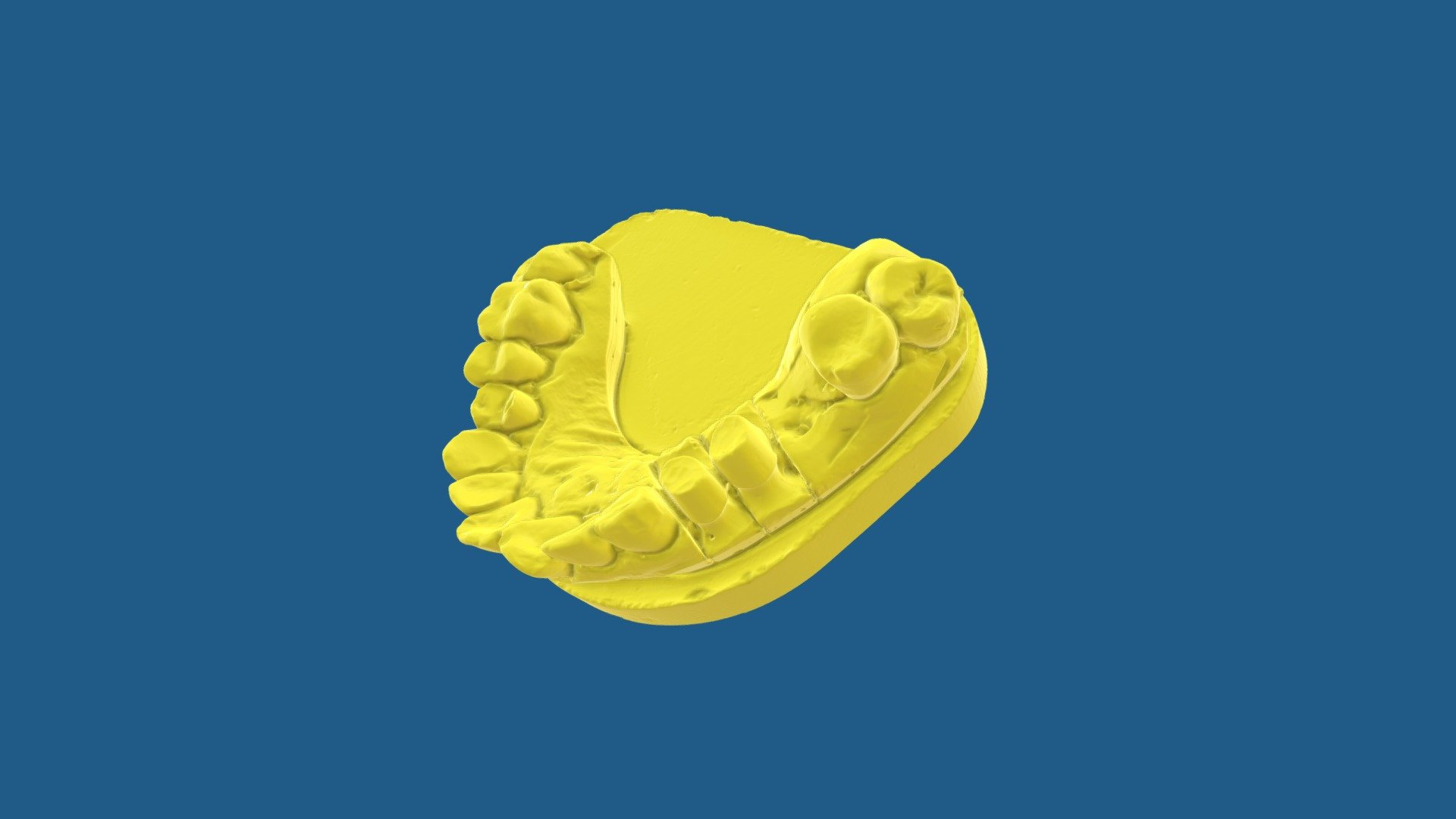 Cast Denture 3D Model by Thunk3D JS500 - 3D model by Thunk3D [9993302 ...