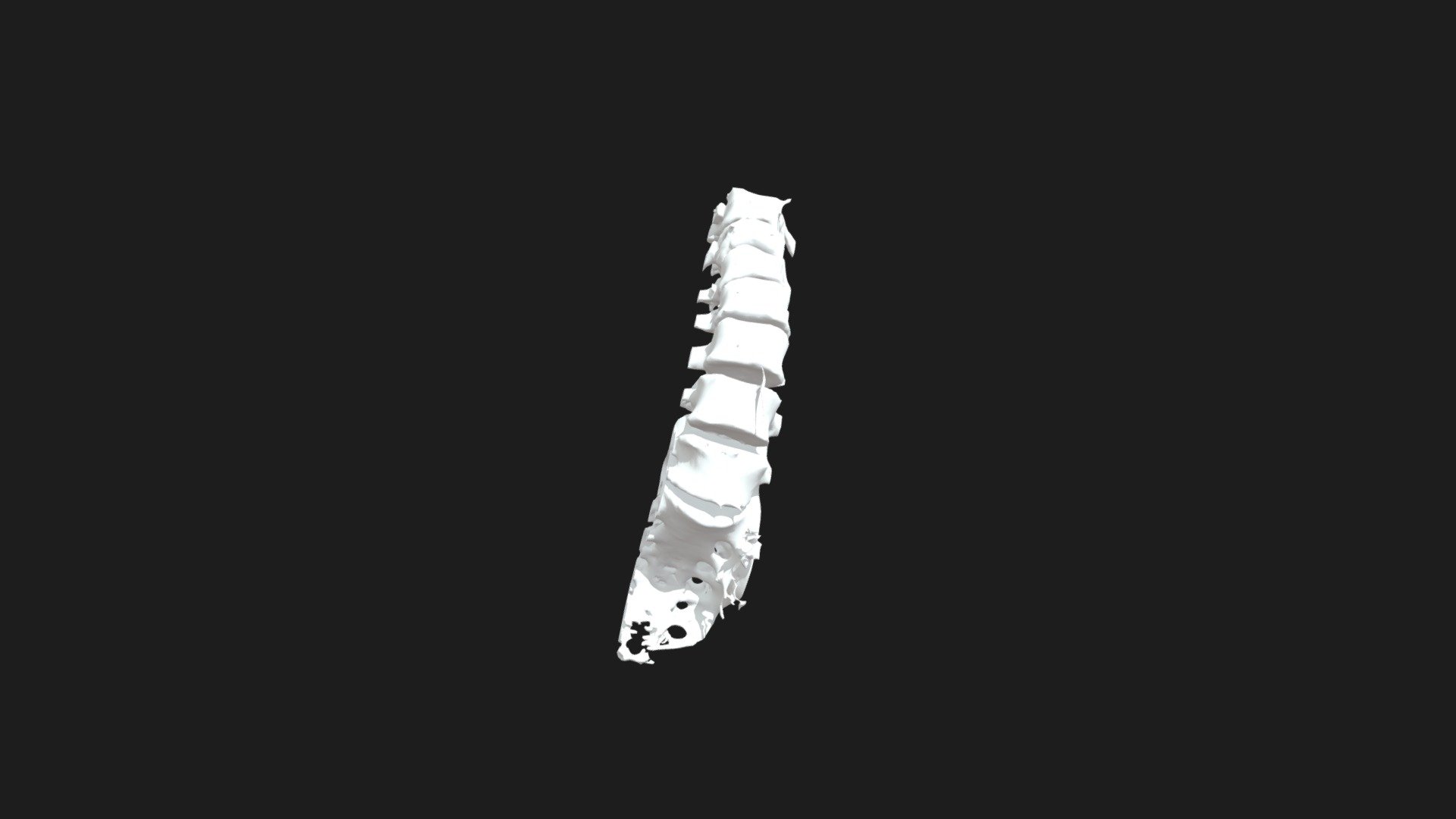 t12 a3 inferior endplate - Download Free 3D model by martinarossitto ...