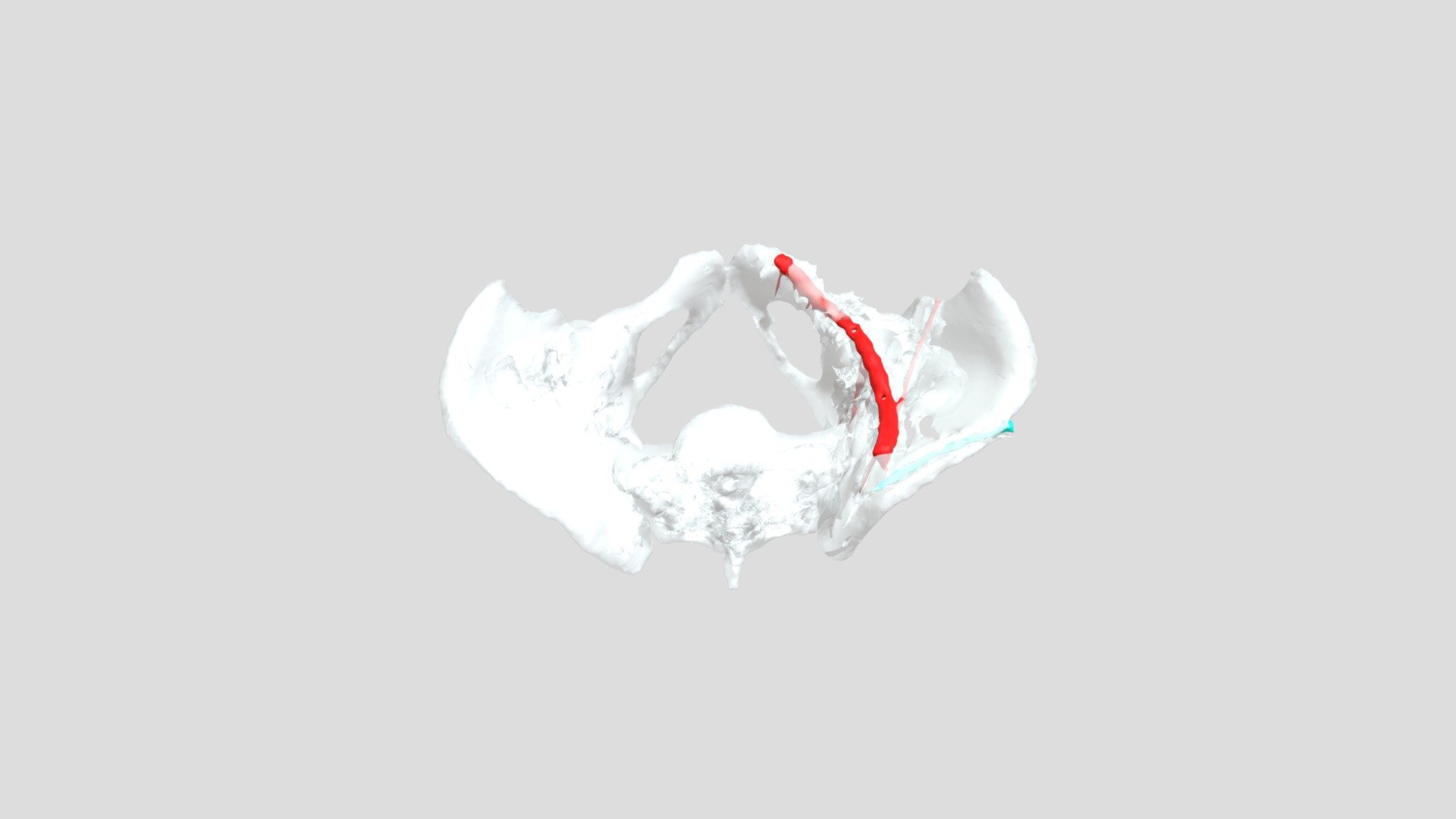 Wendell: Exam 3 Individual Segmentation - Download Free 3D model by ...
