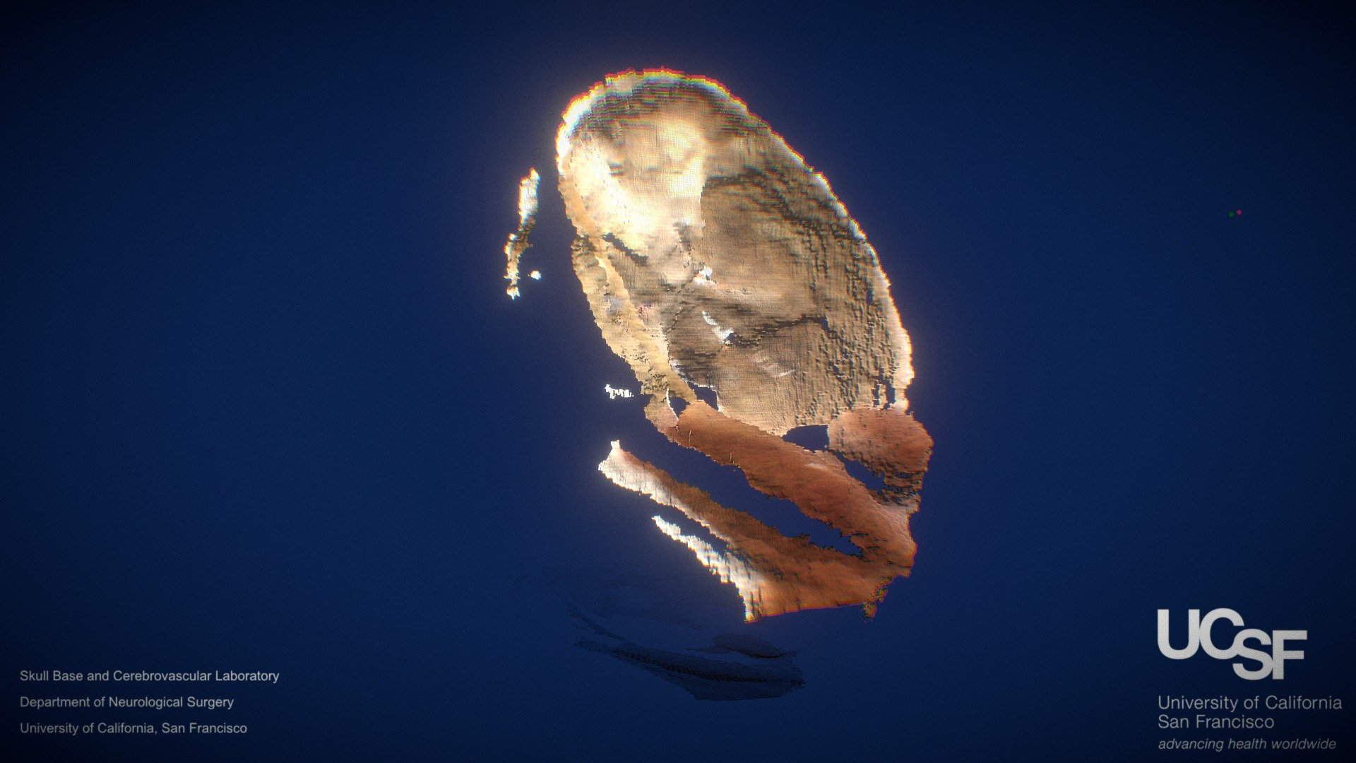 Skull Base - Point Cloud Animation - 3D model by SBCVL_UCSF [9a9c14d ...