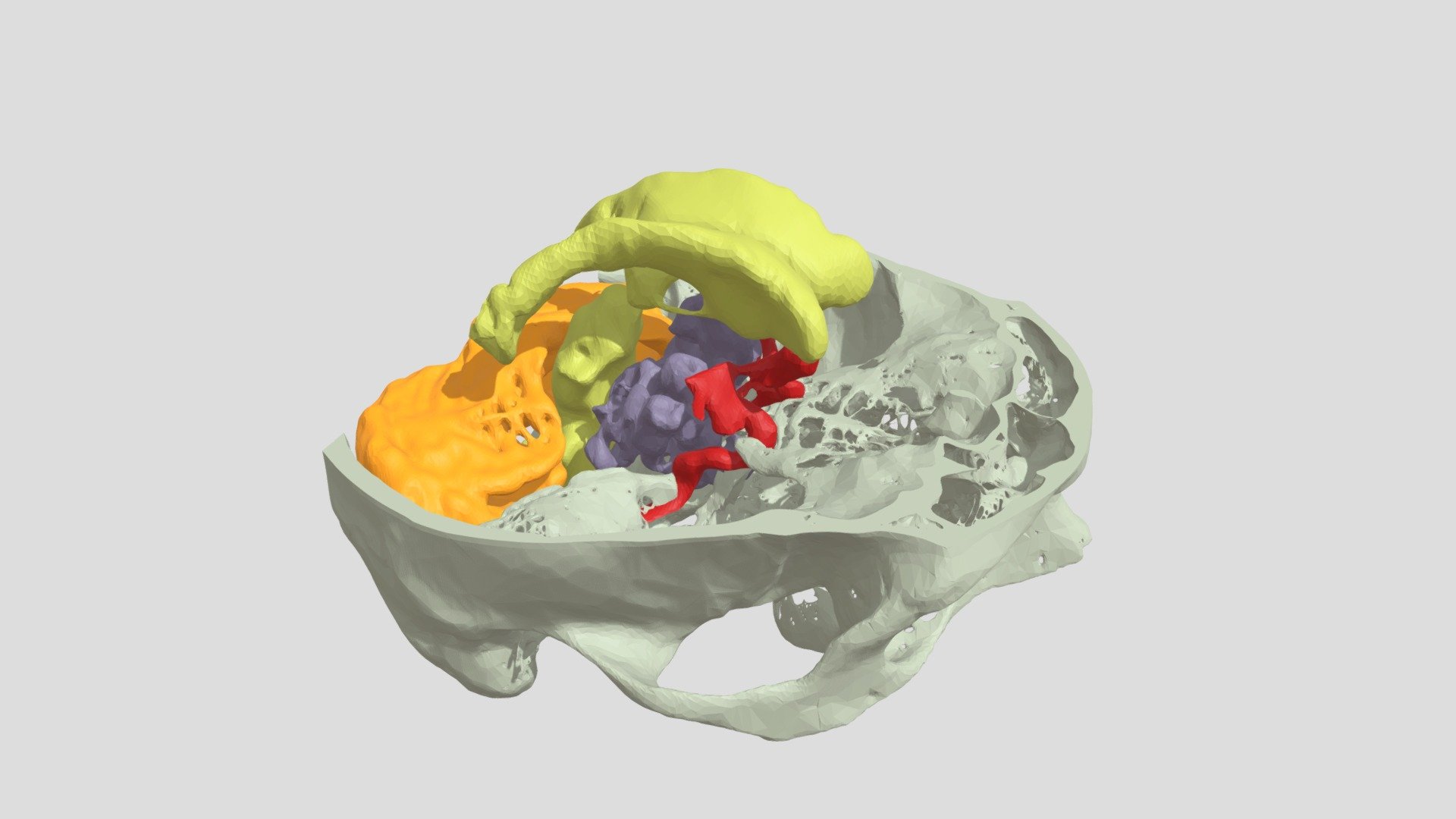 NEURO CHIRURGIA_REV01 - Download Free 3D model by 3Dsurgery [9b1cf75 ...