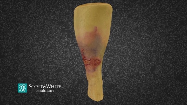 Diabetes 3D models - Sketchfab