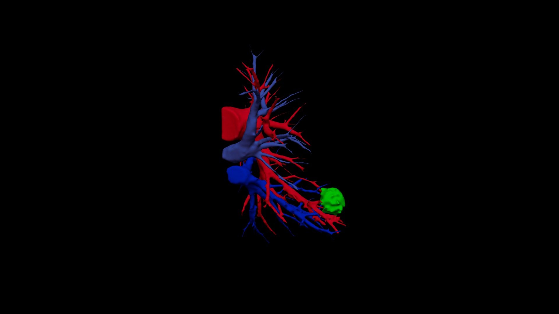 Segmentectomy Download Free 3d Model By Imre J Barabás Md M Sc Uzzias18 [9c2cc4c