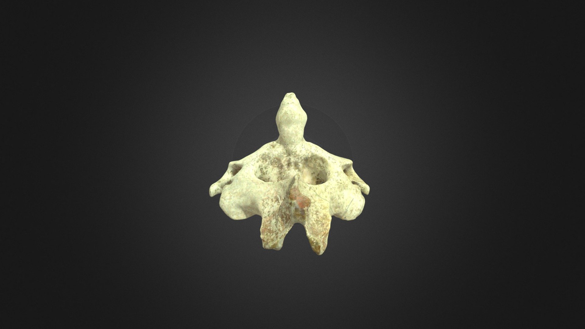Segunda vertebra cervical (C2) Axis - 3D model by morfofuncion_udp ...