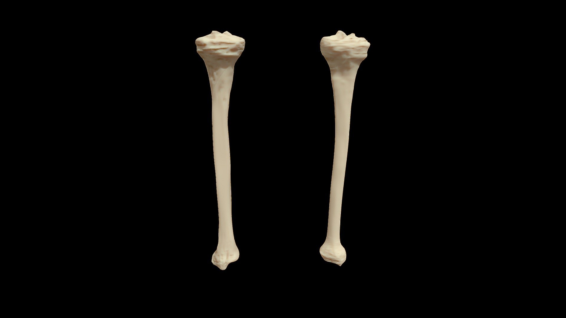tibia bones - 3D model by jxmm [9d5be1d] - Sketchfab