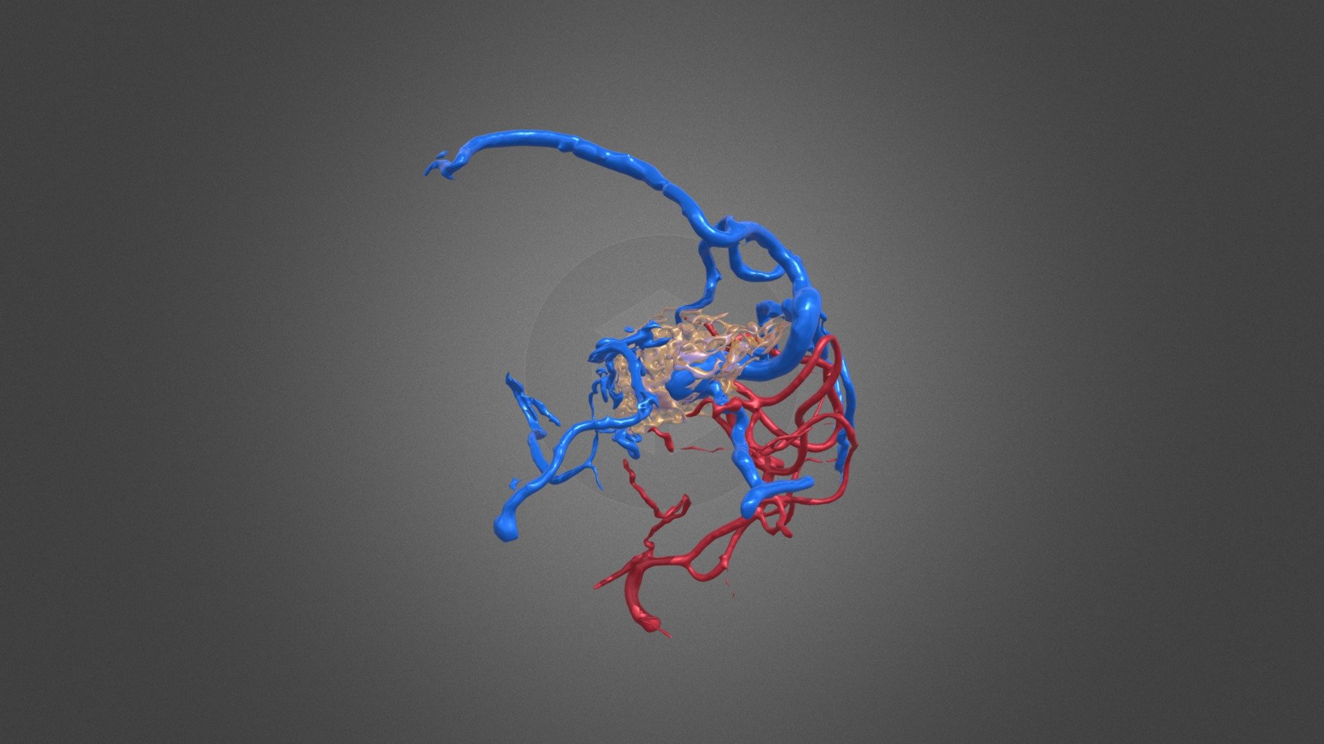 Frontal AVM - Download Free 3D model by jorgegonzalezcantero [9da5e14] - Sketchfab