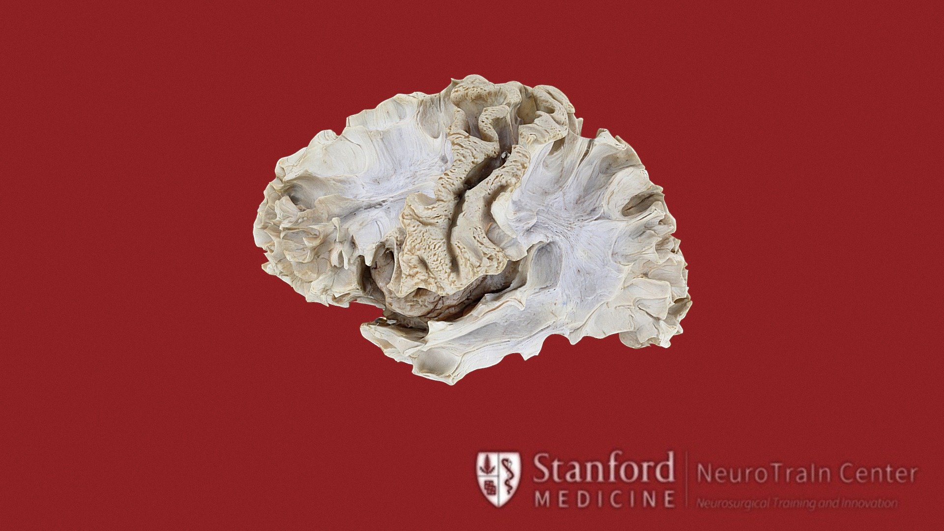 Bilateral Multilayer dissection - 3D model by vv (@verav) [9dc4182 ...