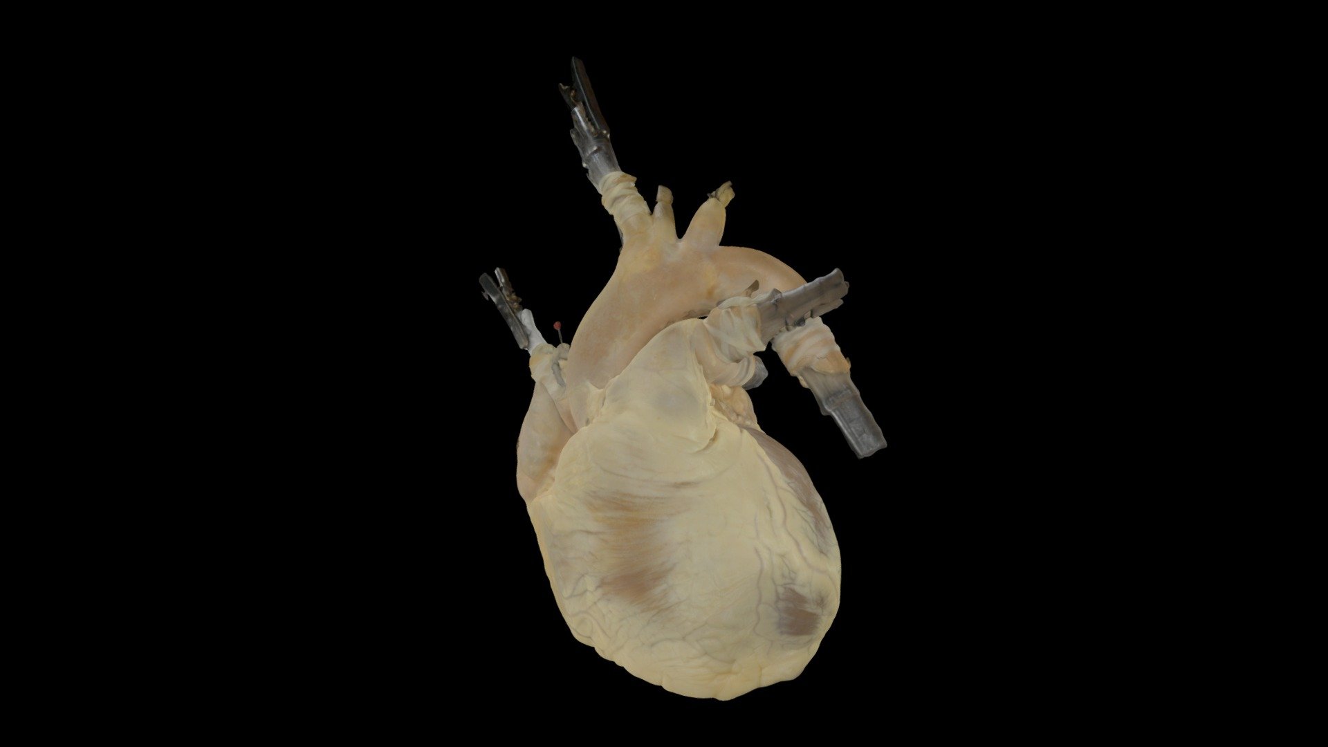 Elderly Fixed Human Heart - Download Free 3D model by VisibleHeartLabs ...