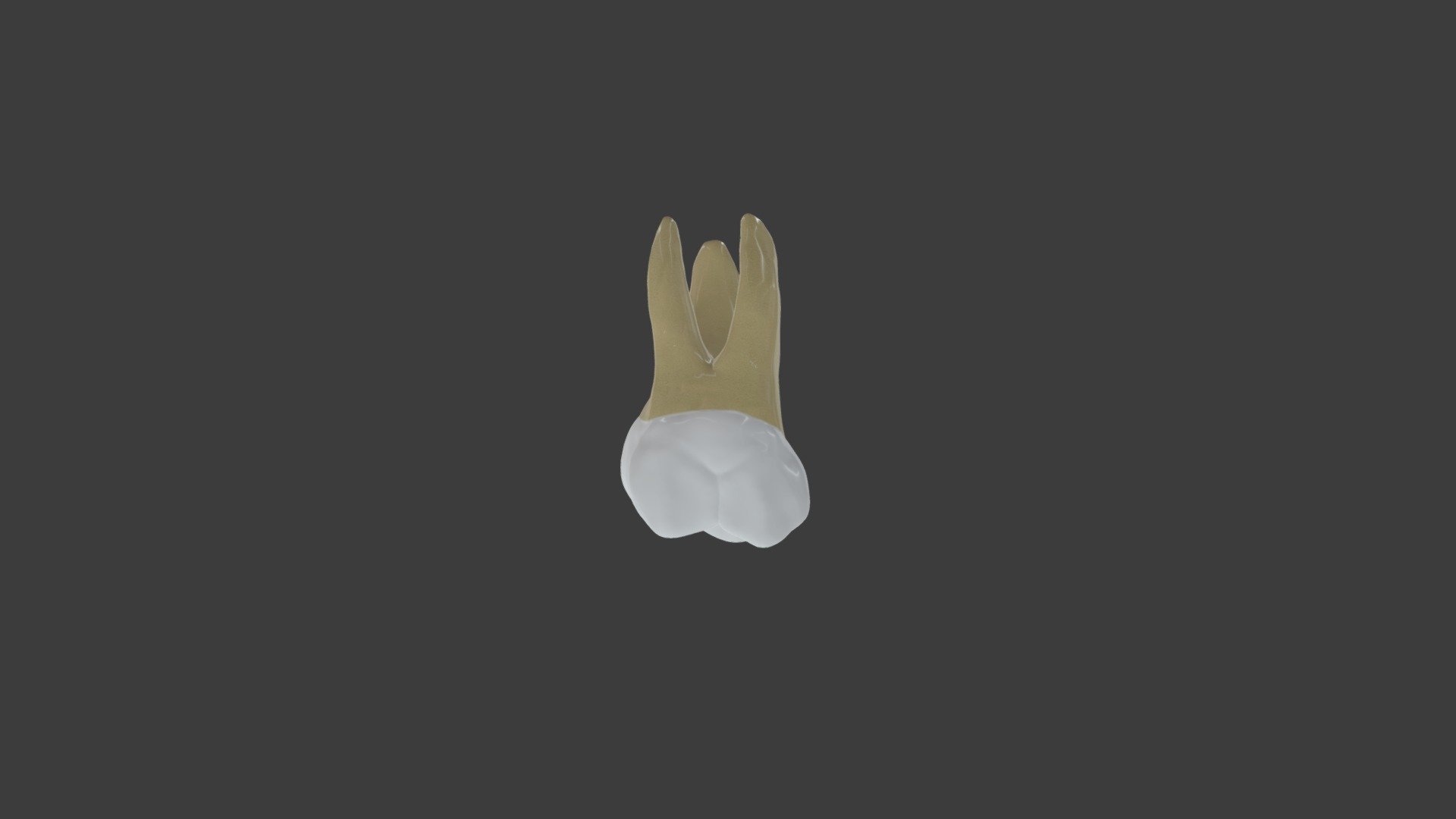 Maxillary First Molar Right - 3D model by Ahmed Mahrous (@drahedmahrous ...