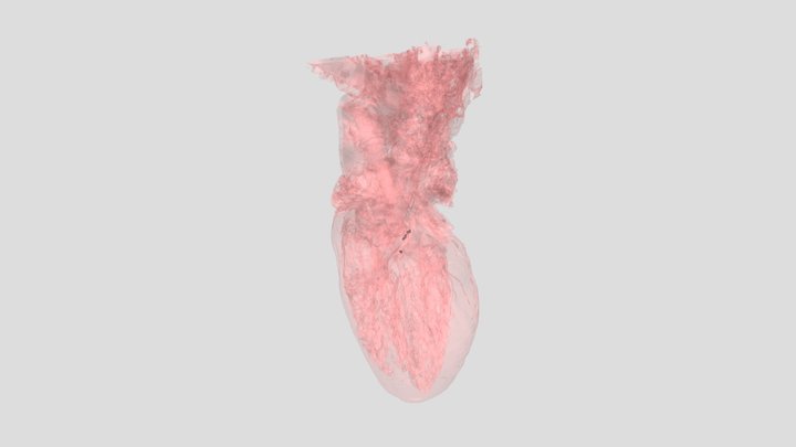 Coronary_artery_disease 3D models - Sketchfab