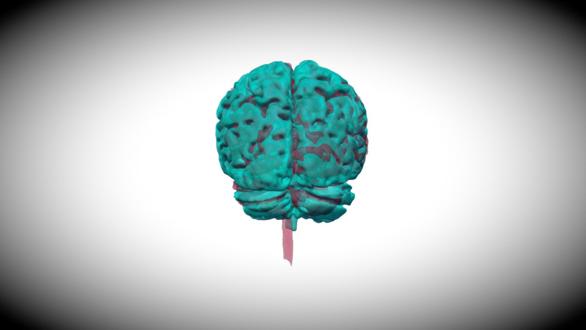 Overlay of Healthy Brain and AD Brain - Download Free 3D model by ...