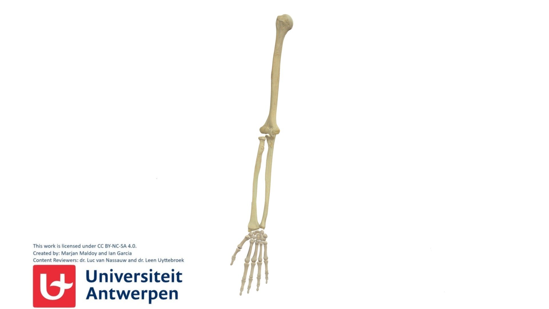 Arm R - 3D model by Universiteit Antwerpen (@marjanmaldoy) [9e54d3d ...