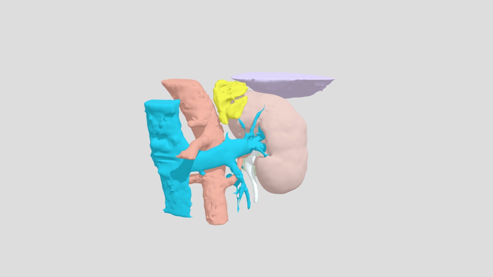 left kidney cancer 2019 - 3D model by zhaowei (@zhaoweiyg) [9f167fc ...