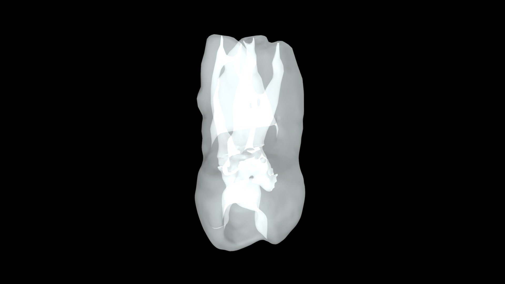 Maxillary Molar #3 with carie - 3D model by biomed3d [9f2d891] - Sketchfab