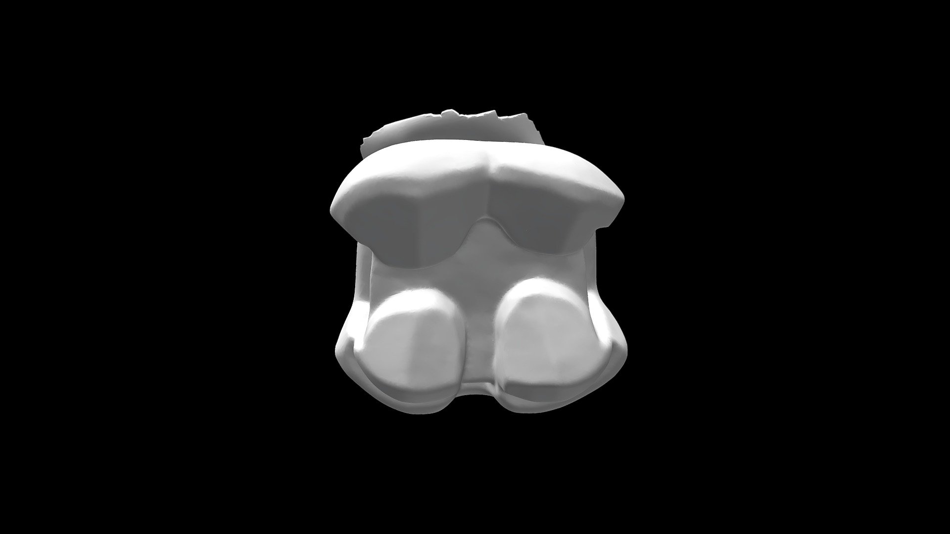 #19 Gold Onlay - 3D model by bchui [9f2f7d9] - Sketchfab