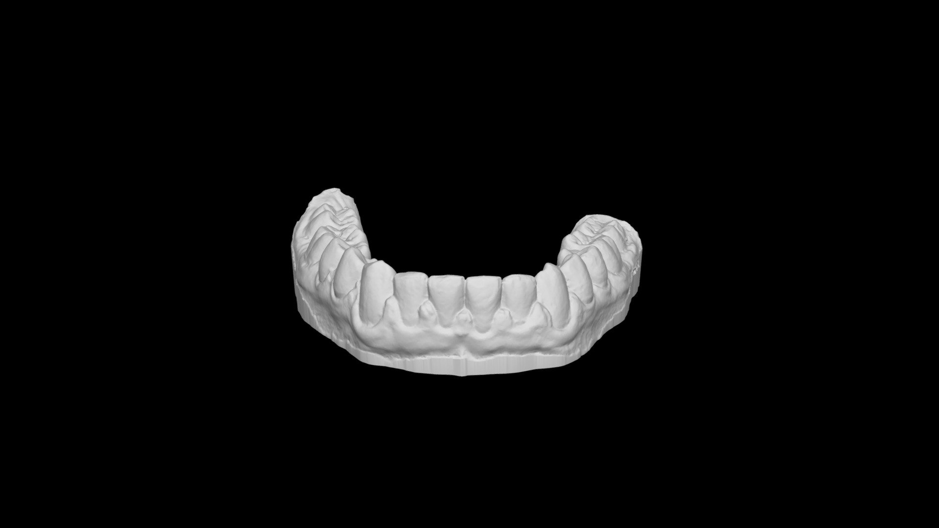 Bottomteeth - 3D model by Joonch [9f39cb7] - Sketchfab
