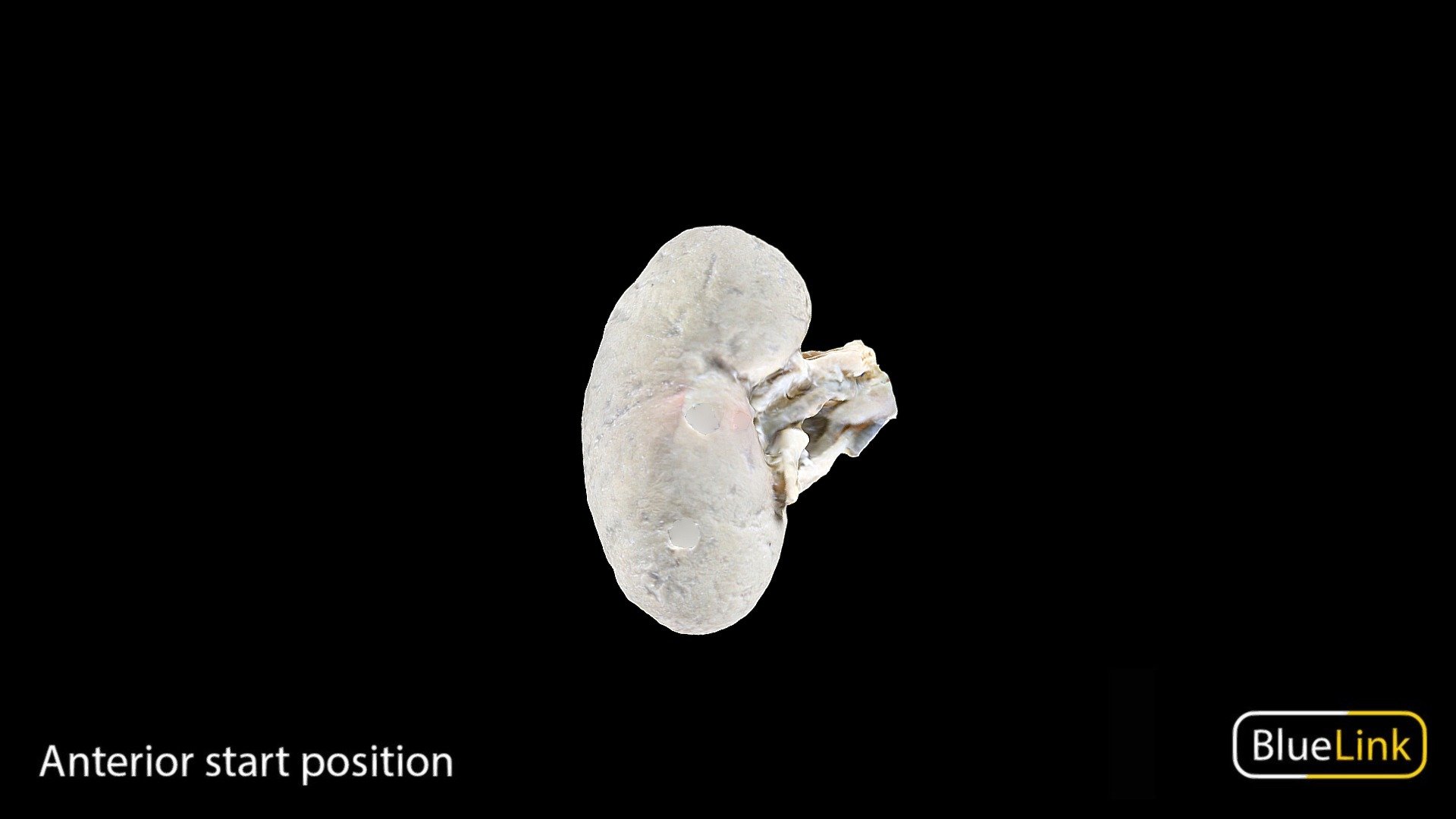 Whole Kidney - 3D model by Bluelink Anatomy - University of Michigan ...