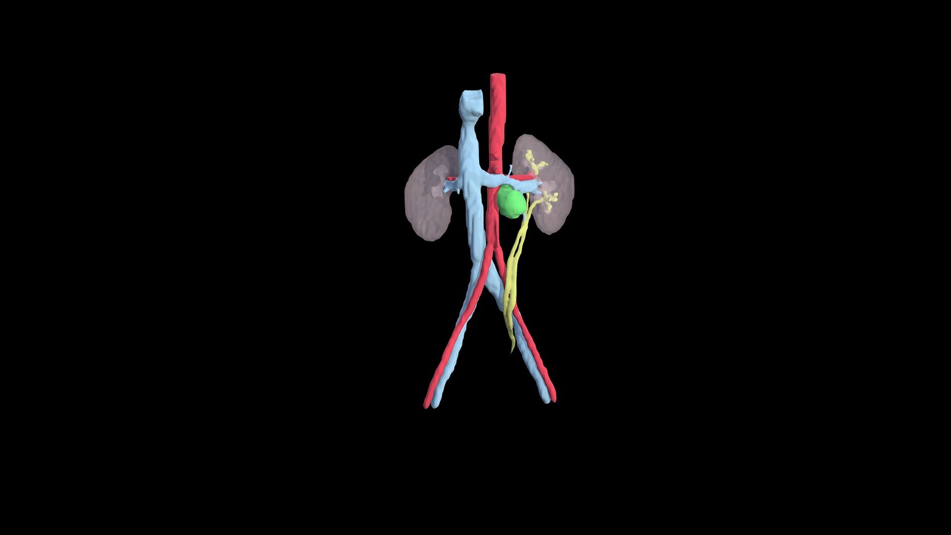Retroperitoneal tumor - 3D model by Cirurgic3D (@neorenal) [9f6ad81 ...