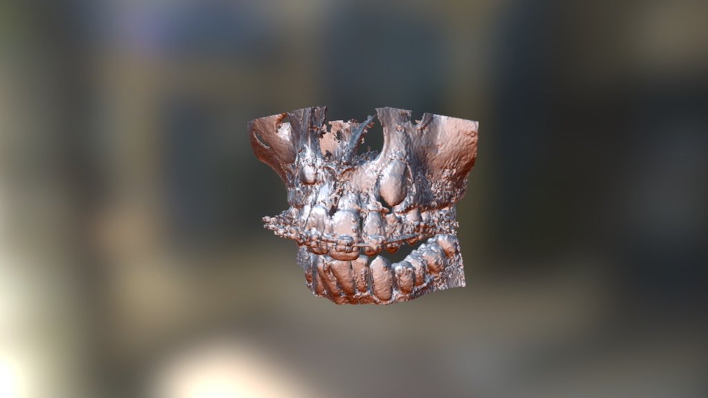 Rithin - 3D model by Medapt [9f91ec6] - Sketchfab