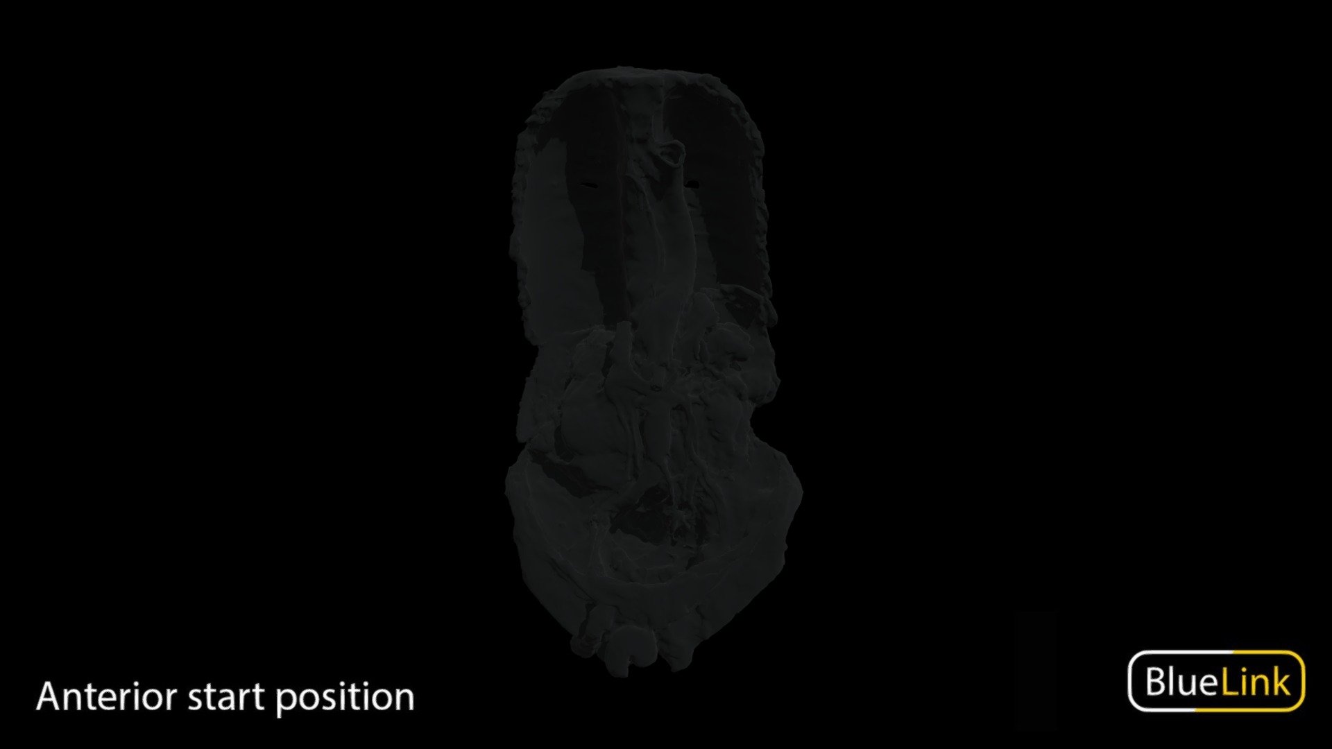 Abdominal Aorta - 3D model by Bluelink Anatomy (@bluelinkanatomy ...