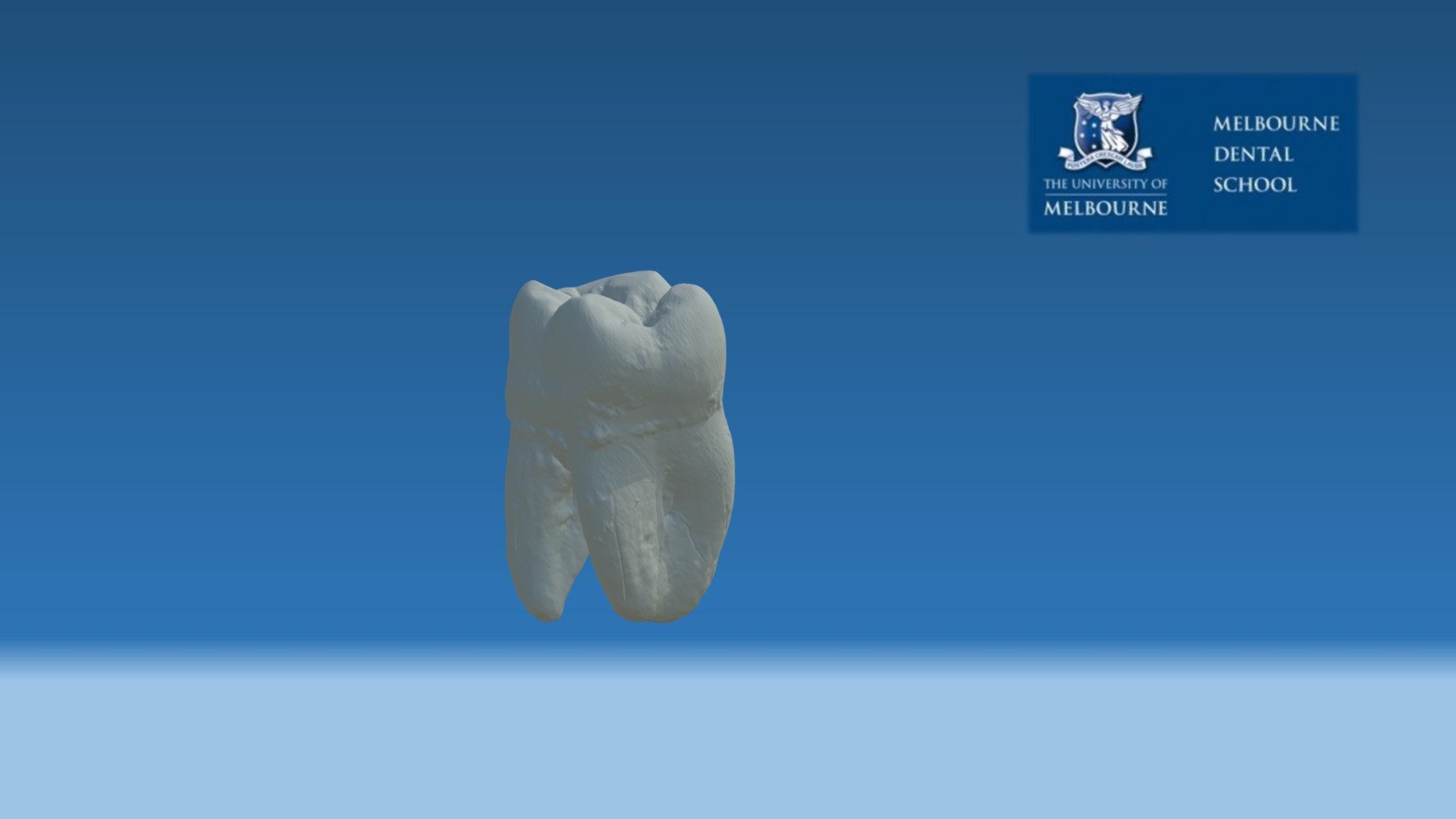Maxillary right first molar (16) - 3D model by Melbourne Dental School ...