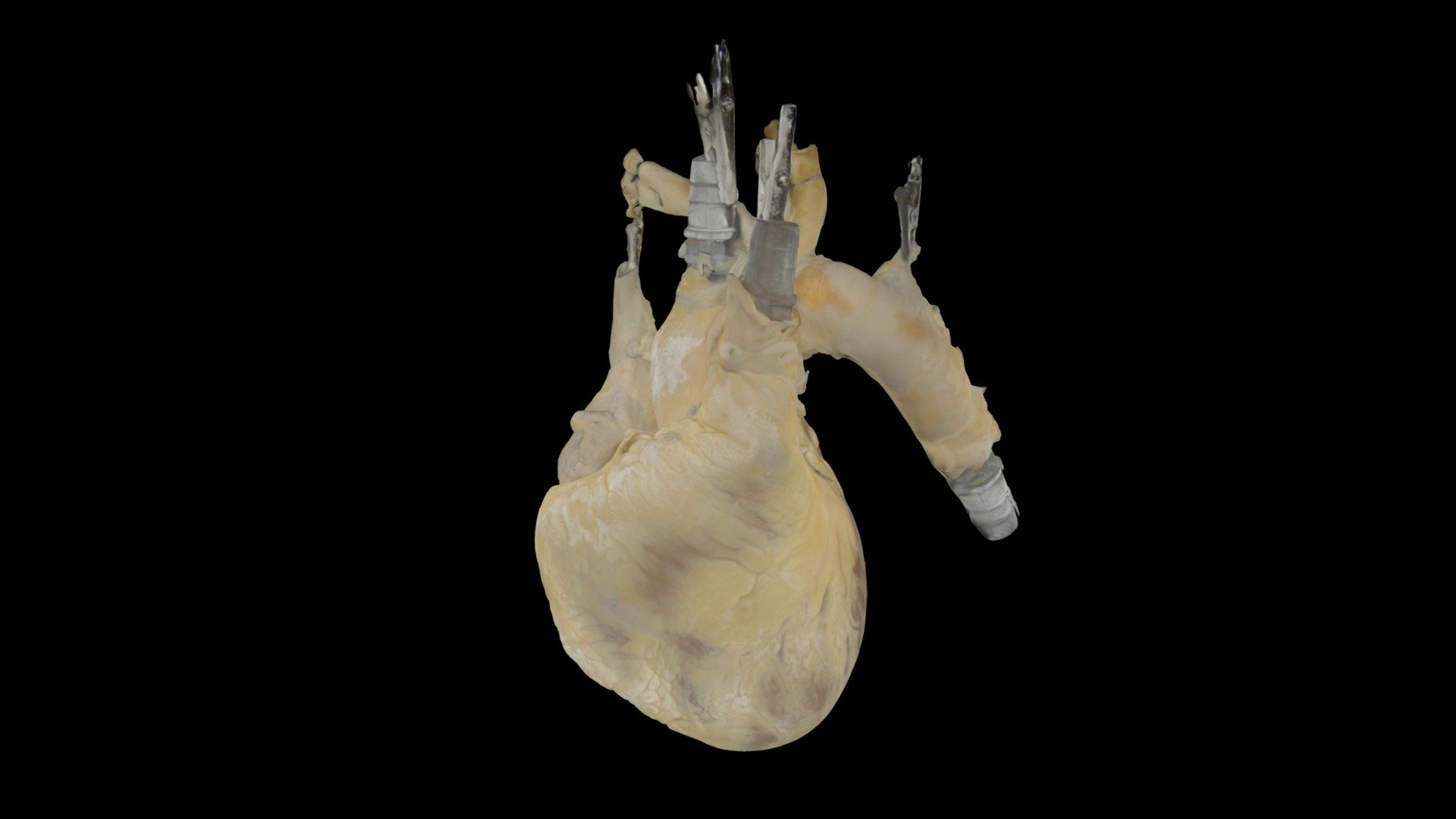 Unique Aorta Anatomy Human Heart - Download Free 3D model by ...