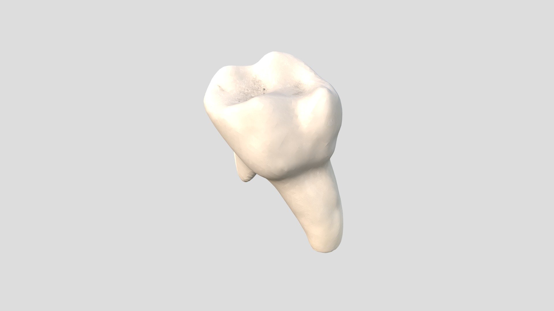 UD3 Tooth (3) - 3D model by anamaria2019 [9fd6850] - Sketchfab