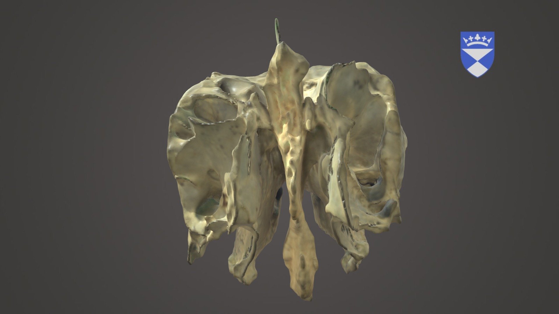 Ethmoid - 3D model by University of Dundee, CAHID (@anatomy_dundee ...