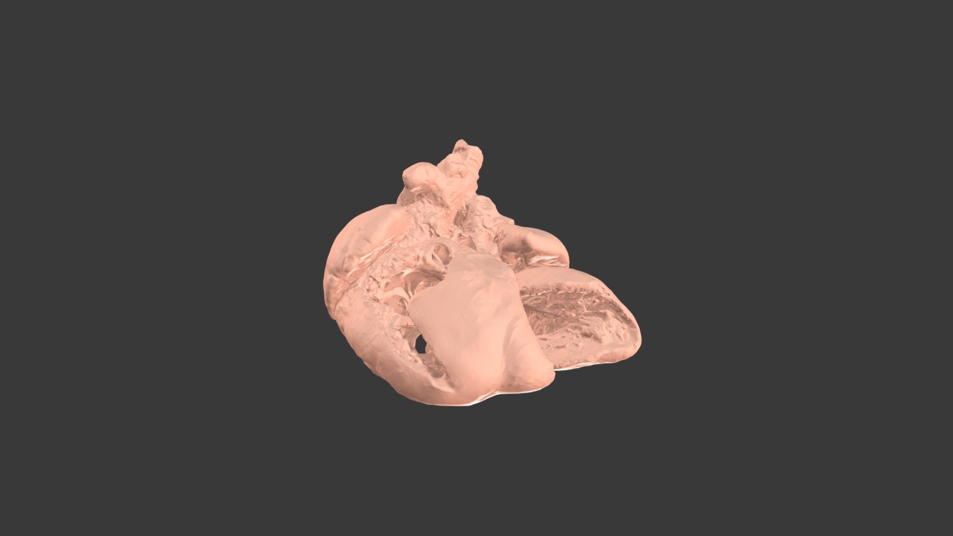TOF #2 - TOF {S,D,S} with PA, ASD 2 - 3D model by heartmodels [a063bfb ...