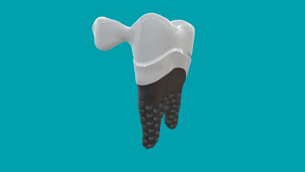 Anatomie des REPLICATE® Systems - 3D model by Natural Dental Implants ...