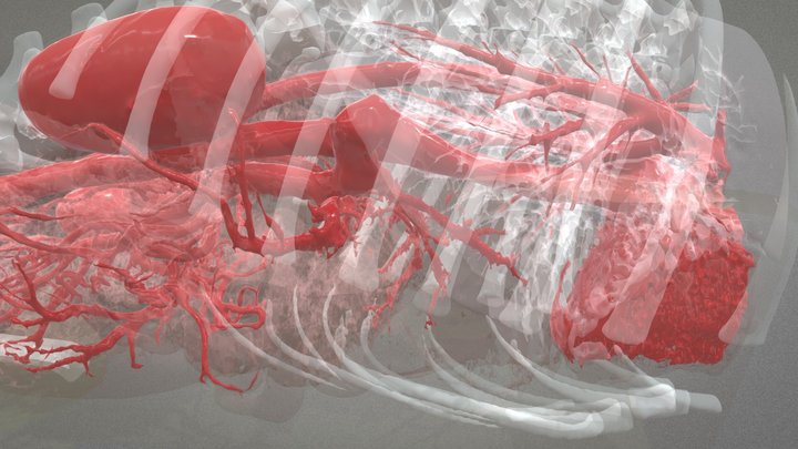 Shunt 3D models - Sketchfab