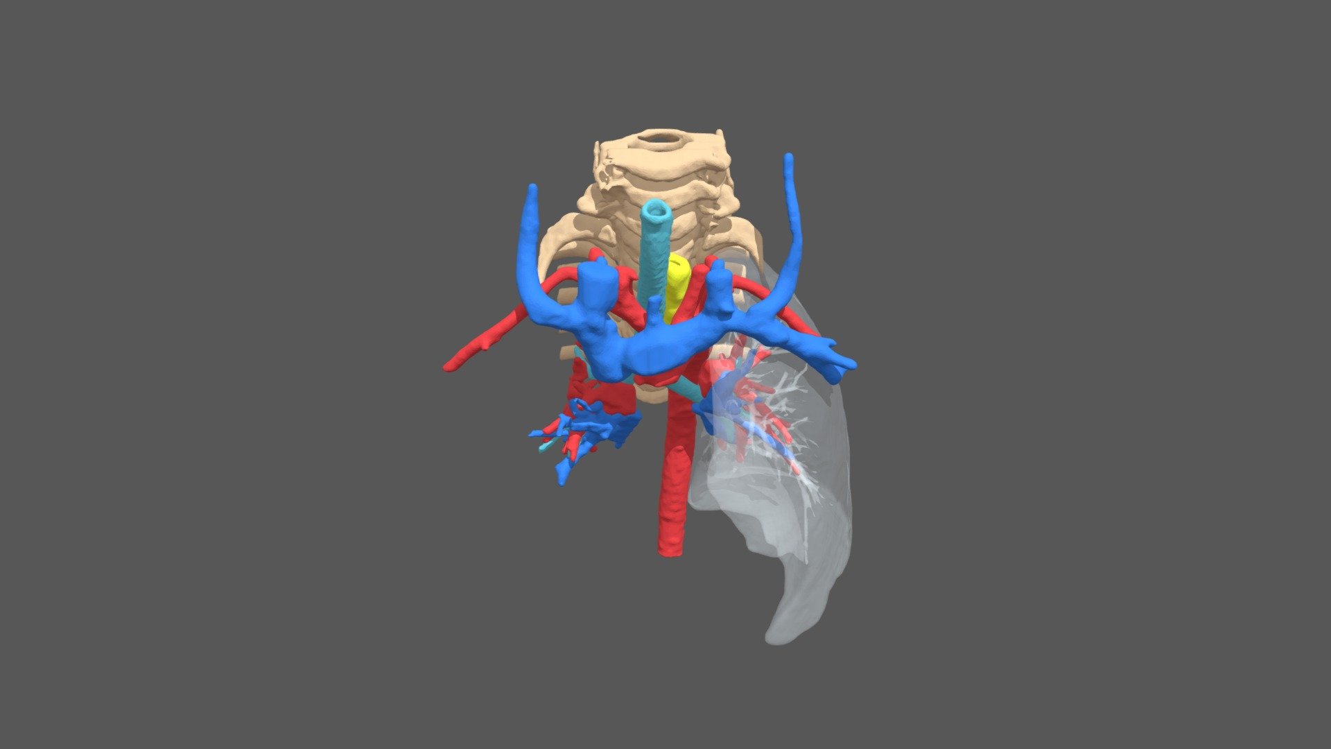 Inflammatory myofibroblastic tumor - 3D model by thorac.topsurgery ...