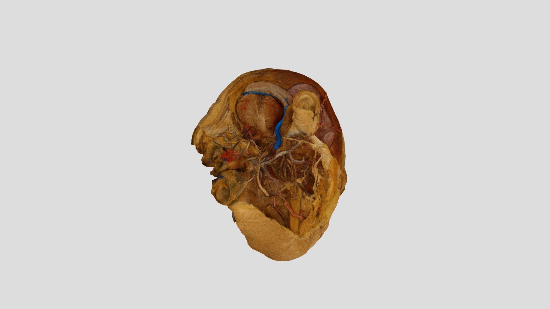 10- Tempora Removed, Mastoid Drilled, SMF - 3D model by mozgury [a1ca55d] - Sketchfab