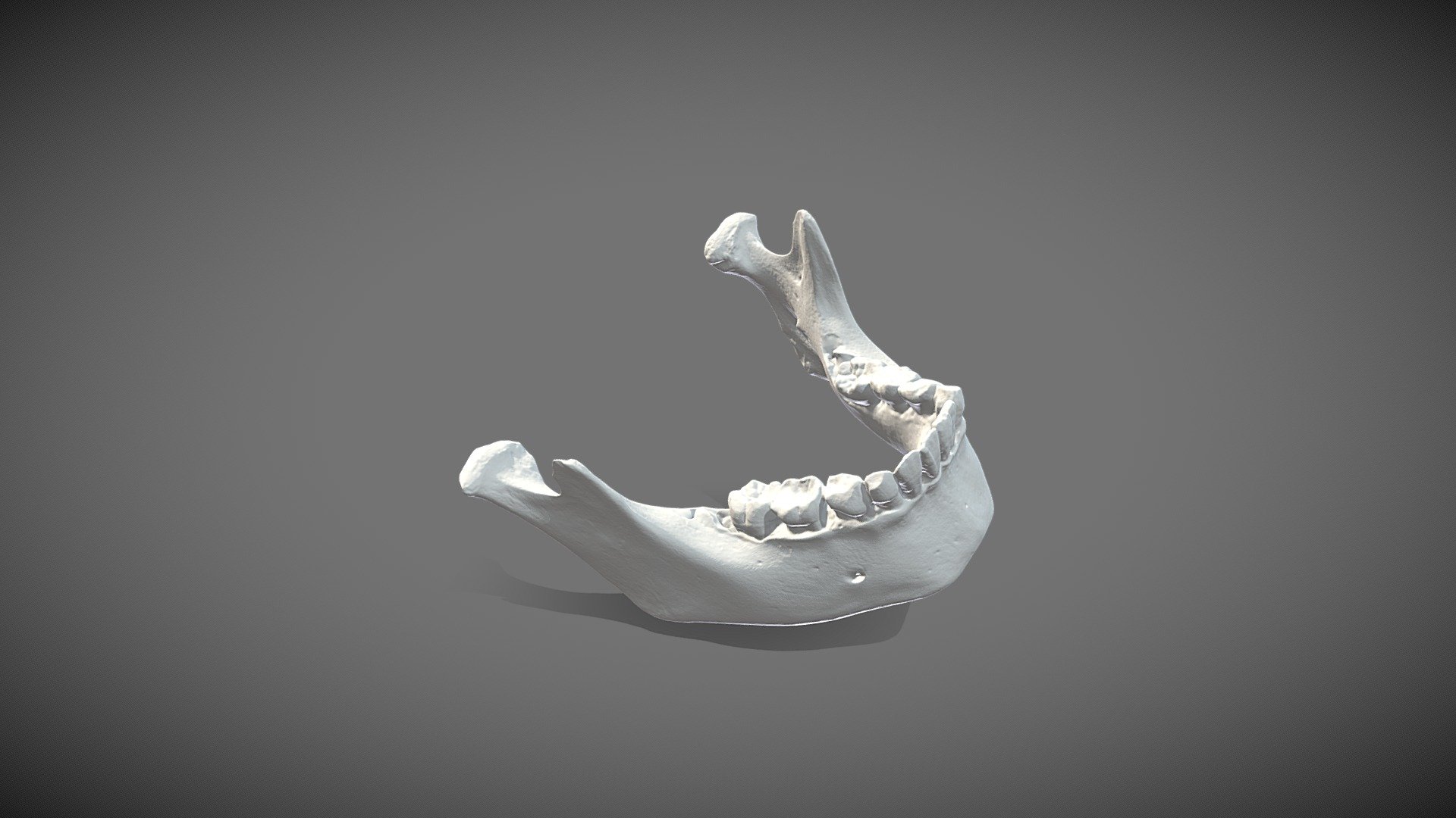 mandible child - Download Free 3D model by George A. Rauscher ...