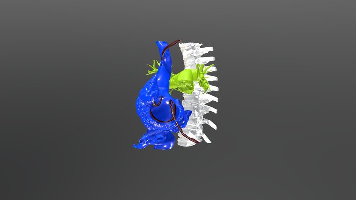 Pacemaker 3D models - Sketchfab